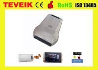 China Wireless color doppler ultrasound machine price wireless color doppler ultrasound probe for ios/android for sale