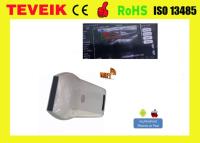 China Wireless color doppler ultrasound machine price wireless color doppler ultrasound probe for ios/android for sale