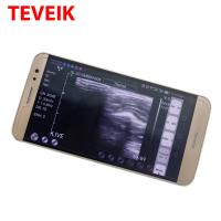 China USB Ultrasound Transducer Probe Convex for IOS, Android and Windows for sale
