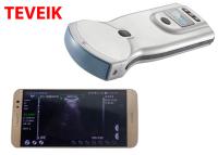 China Low Price Wireless Ultrasound Probe Mobile Gyne Ultrasound Machine for sale