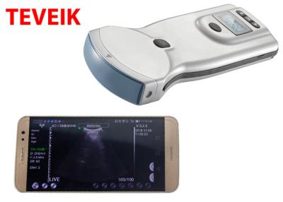 China Low Price Wireless Ultrasound Probe Mobile Gyne Ultrasound Machine for sale