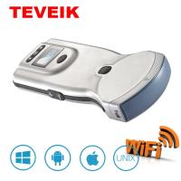 China Low Price Wireless Ultrasound Probe Mobile Gyne Ultrasound Machine for sale