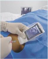 China Medical Wifi Ultrasound Machine Android Portable Wireless Ultrasound Probe Linear for sale