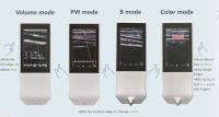 China Medical Wifi Ultrasound Machine Android Portable Wireless Ultrasound Probe Linear for sale