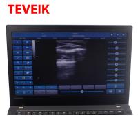 China Medical Ultrasound Instruments USB Protbble Ultrasound Linear Probe for sale