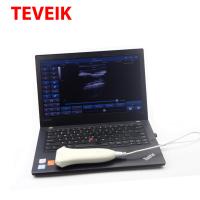 China Medical Ultrasound Instruments USB Protbble Ultrasound Linear Probe for sale