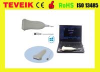 China Hot sale USB Linear Ultrasound Probe U20L7.5 For Phone / Pad / PC / Laptop for sale