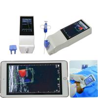 China Wireless Ultrasound Tranducer Android Color Doppler Ultrasound Probe Wireless Charging for sale