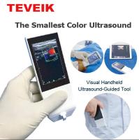 China Wireless Ultrasound Tranducer Android Color Doppler Ultrasound Probe Wireless Charging for sale