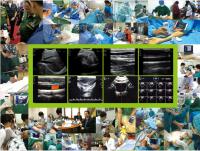 China Color Doppler Wireless Ultrasound Probe 2 In 1 Handheld Convex Linear Type for sale