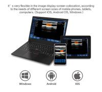 China Double Heads Wireless Ultrasound Probe 3 In 1 Cardiac Convex Linear Color Doppler for sale