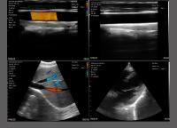 China Double Heads Wireless Ultrasound Probe 3 In 1 Cardiac Convex Linear Color Doppler for sale