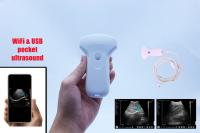China Visual Convex Array Usb Wifi Ultrasound Probe for sale