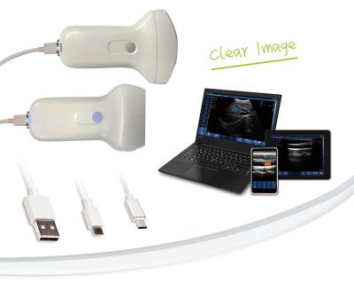 China Linear 7.5Mhz 2.4G Wifi Wireless Ultrasound Probe 40mm Length for sale
