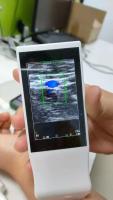 China Medical Wifi Ultrasound Machine Android Portable Wireless Ultrasound Probe Linear for sale