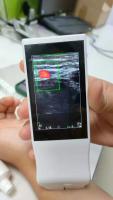 China Medical Wifi Ultrasound Machine Android Portable Wireless Ultrasound Probe Linear for sale