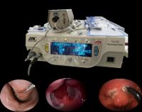 China Cold Plasma Device for Snoring,CAUP,UPPP,Tonsillectomy, Adenoidectomy,Papilloma, Polypus,Tumor surgeries for sale