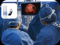 China ENT surgery instruments Plasma Surgery System and Disposable Plasma Probe for Tonsillectomy and Adenoidectomy for sale