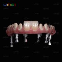 China Aesthetic Full Arch Dental Implant Bridge Lightweight Solid Titanium Marlow Bridge for sale