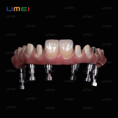 China Aesthetic Full Arch Dental Implant Bridge Lightweight Solid Titanium Marlow Bridge for sale