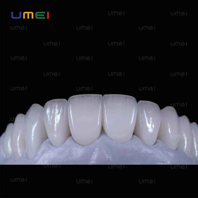 China Porcelain Dental Veneers Stain Proof Lithium Disilicate Veneers For Corrects Imperfections for sale
