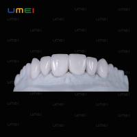 China Minimally Invasive Dental Veneer Translucent High Strength Hollywood White Veneers for sale