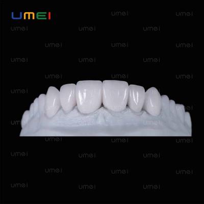 China Minimally Invasive Dental Veneer Translucent High Strength Hollywood White Veneers for sale