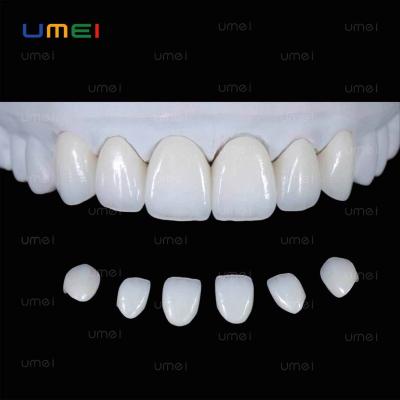 China Ultra Simulated Dental Zirconia Veneers Biocompatible Aesthetic Veneers for sale