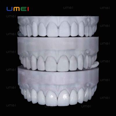 China Strong Dental Veneer Minimally Invasive Dental Clinic Veneers Ultra Thin for sale