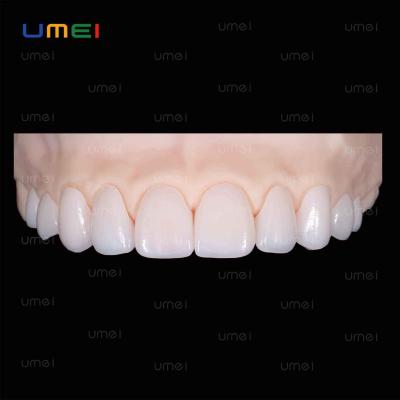 China Durable Whitening Porcelain Veneers , High End Transparent Dental Clinic Veneers for sale