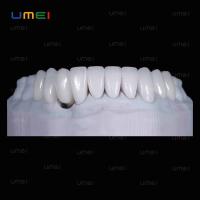 China Customized Ceramic Dental Veneers High Temperature Firing Esthetic Veneer for sale