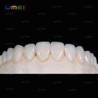 China Minimally Invasive Cosmetic Dentistry Porcelain Veneers Ultra Thin Wear Resistant for sale