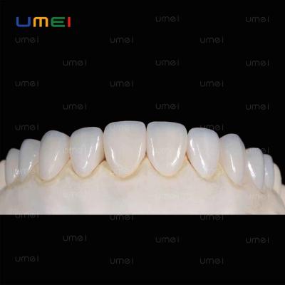 China Minimally Invasive Cosmetic Dentistry Porcelain Veneers Ultra Thin Wear Resistant for sale
