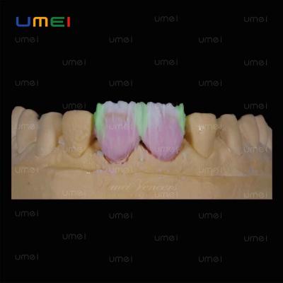 China Natural White Cast Porcelain Laminate Veneers , Dental Layered Emax Veneers for sale