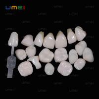 China Durable Dental Whitening Veneers Stain Proof Dentistry Refractory Veneer for sale