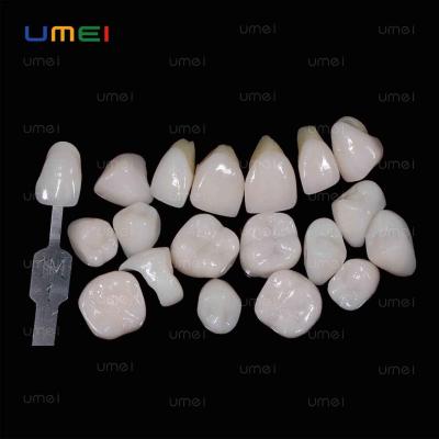 China Durable Dental Whitening Veneers Stain Proof Dentistry Refractory Veneer for sale