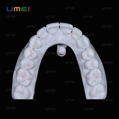 China Comfortable Painless Veneers Ultra Thin Biocompatible Dental Lab Veneers for sale