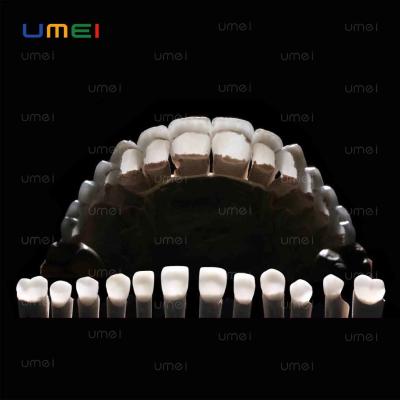 China High Aesthetic Refractory Veneer Stain Proof For Cosmetic Dentistry for sale
