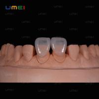 China Transparent Dental Veneer Natural Bright White Veneers Stain Resistance for sale