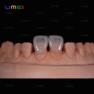 China Transparent Dental Veneer Natural Bright White Veneers Stain Resistance for sale