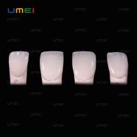 China Ultra Thin Aesthetic Porcelain Veneers Stain Resistant Minimal Invasiveness for sale