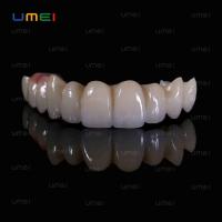 China Malo Bridge-Removable Crowns-Natural Aesthetics for sale