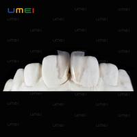 China Strong Porcelain Teeth Veneers Ultra Thin High Translucency for sale