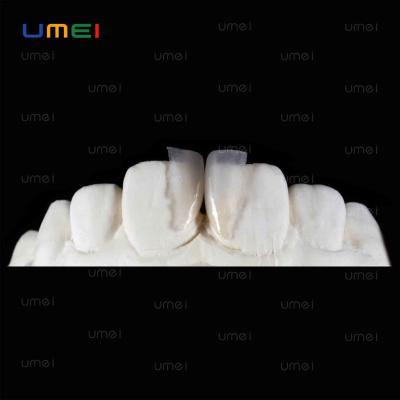 China Strong Porcelain Teeth Veneers Ultra Thin High Translucency for sale