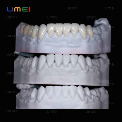 China Ultra Thin Cosmetic Dentistry Porcelain Veneers Stain Proof High Durability for sale