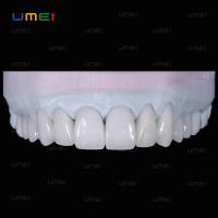 China Ultra Thin Dental Veneers Wear Resistant Natural Aesthetic Veneers for sale