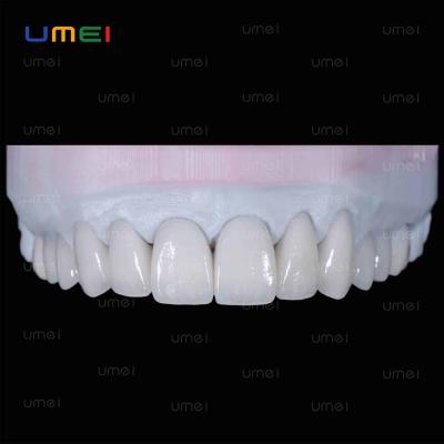 China Ultra Thin Dental Veneers Wear Resistant Natural Aesthetic Veneers for sale