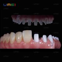 China High Strength Full Arch Zirconia Bridge Lightweight Aesthetic Dental Zirconia Bridge for sale