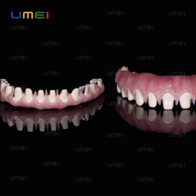 China Monolithic Zirconia Bridge , Biocompatibility Full Arch Implant Bridge for sale