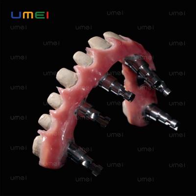 China Robust Full Arch Zirconia Bridge , Malo Bridge Dental Corrosion Resistant for sale